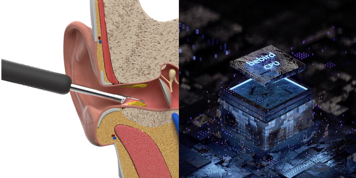 Купить черную ушную палочку Xiaomi Bebird Smart Ear Rod R1 в городе ...